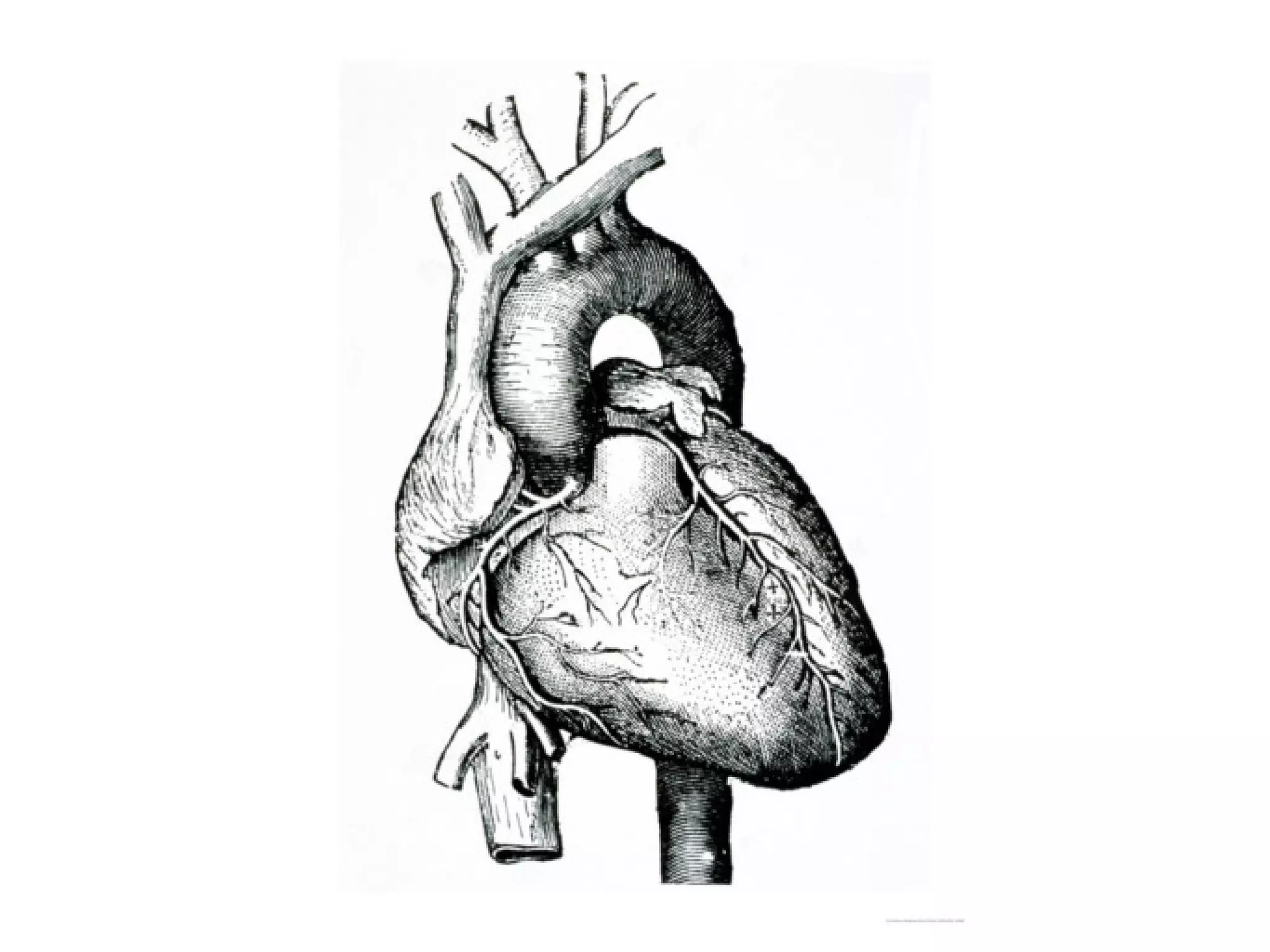 Cardiac Trauma Lecture | PDF