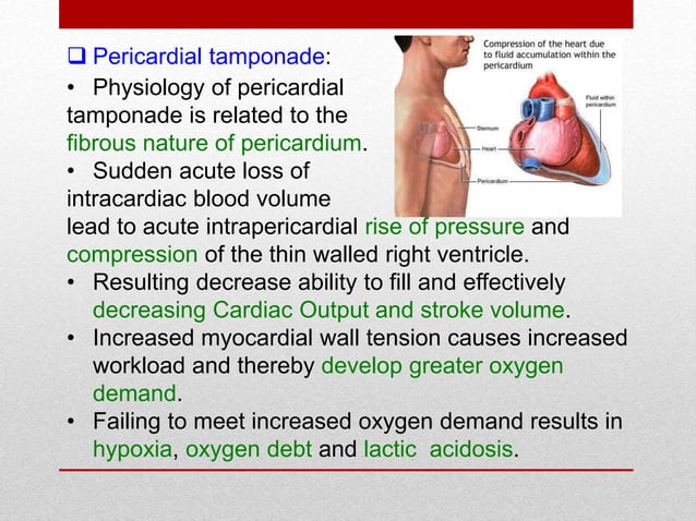 Cardiac trauma management | PPTX | Death, Injury, or Military Conflict | Sensitive Topics