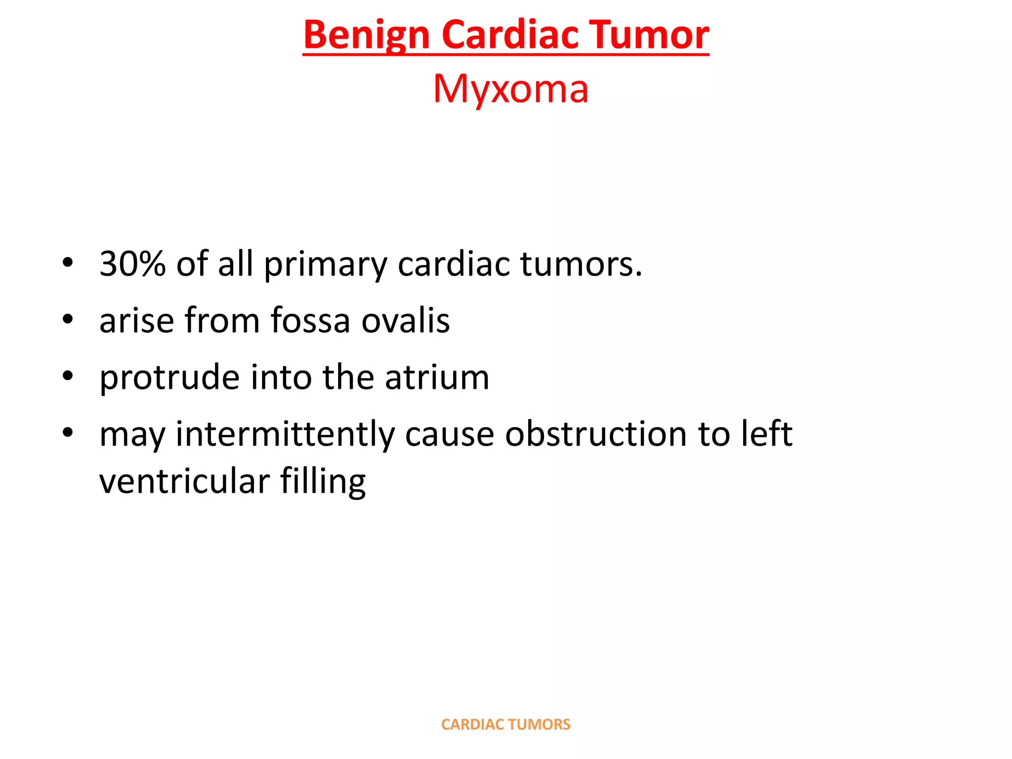 Cardiac tumors | PPTX