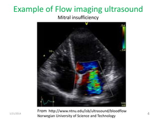 Color flow medical cardiac ultrasound | PPTX