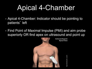 Cardiac Ultrasound Made Easy-Hamisi Mkindi.pptx