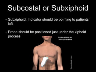Cardiac Ultrasound Made Easy-Hamisi Mkindi.pptx
