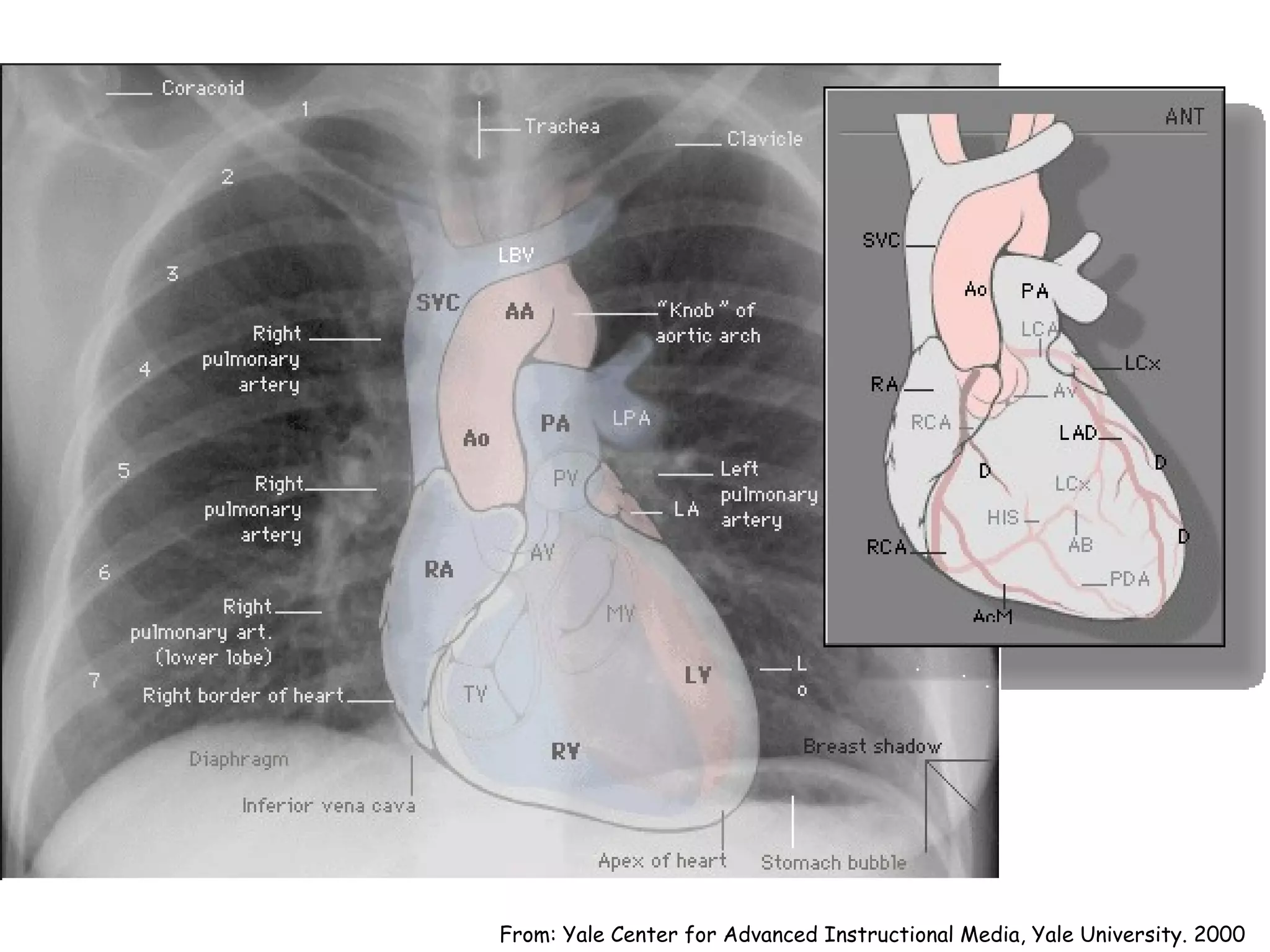 Cardiac Us | PPT
