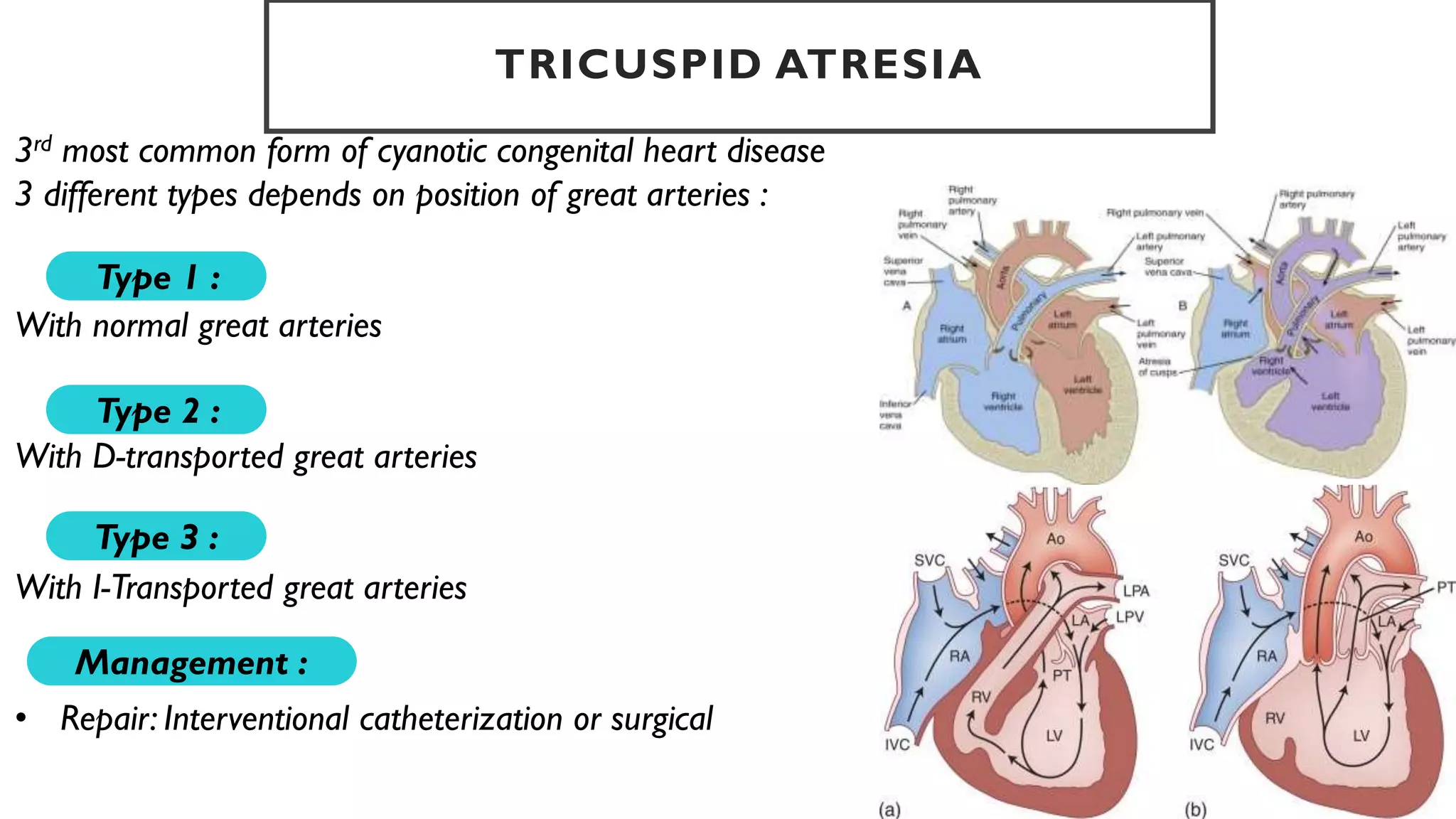 The anatomy of the cardiac valves and their abnormalities | PPTX