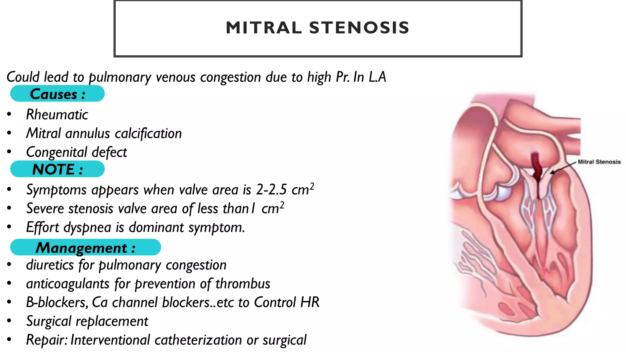 The anatomy of the cardiac valves and their abnormalities | PPTX
