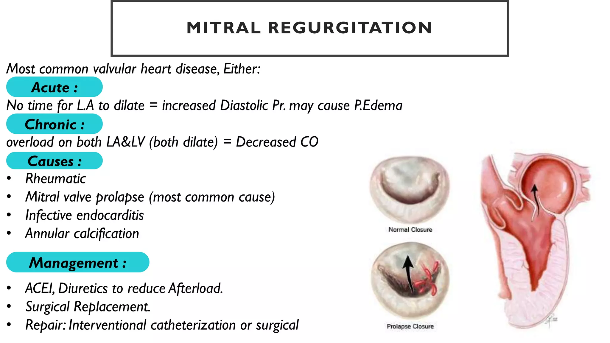 The anatomy of the cardiac valves and their abnormalities | PPTX