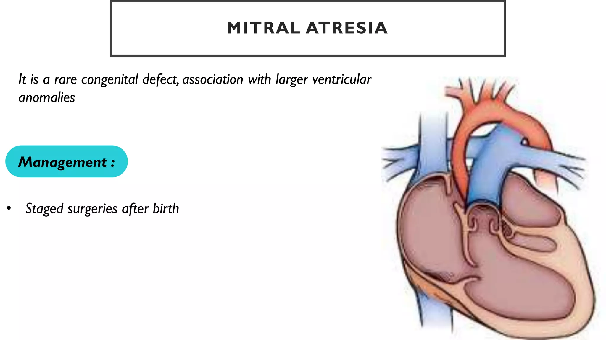 The anatomy of the cardiac valves and their abnormalities | PPTX