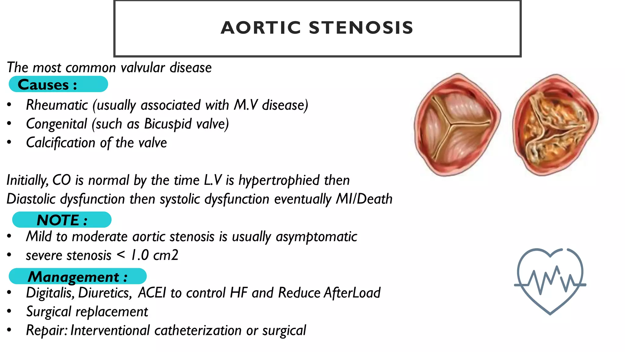 The anatomy of the cardiac valves and their abnormalities | PPTX