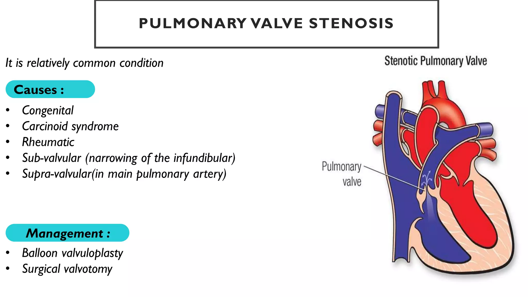 The anatomy of the cardiac valves and their abnormalities | PPTX