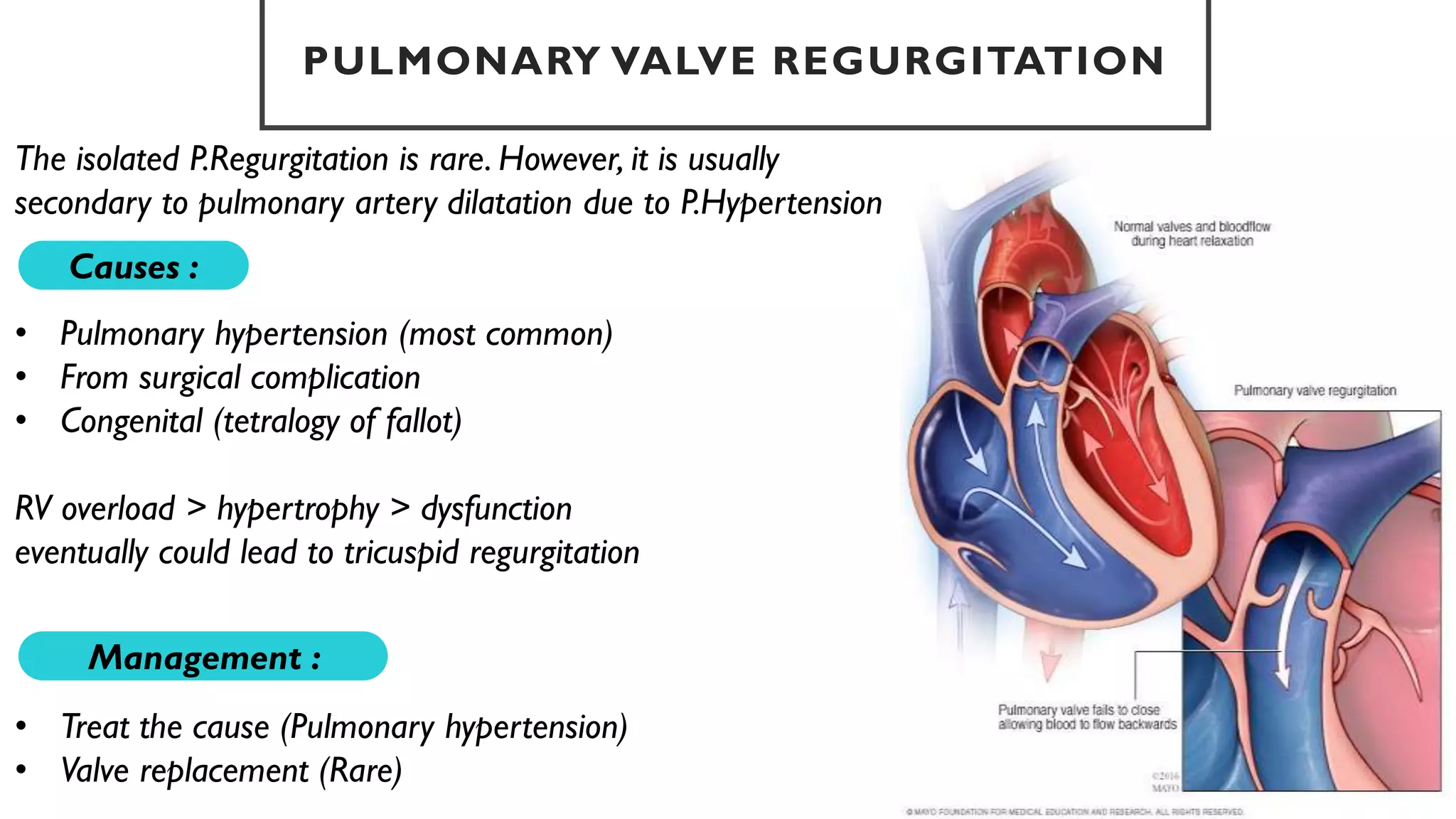 The anatomy of the cardiac valves and their abnormalities | PPTX