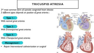 The anatomy of the cardiac valves and their abnormalities | PPTX ...