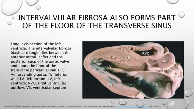 Cardiac valves and skeleton & With applied aspects -final 1.pptx