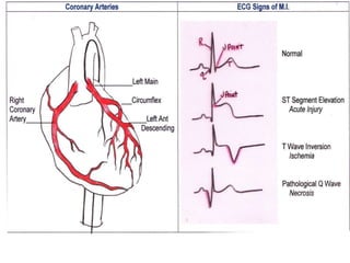 Cardiac vector and axis | PPTX