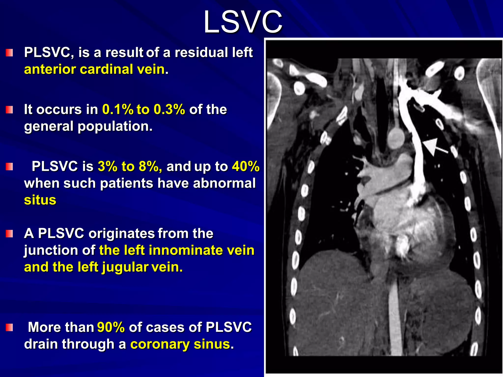Cardiac venous system | PPTX