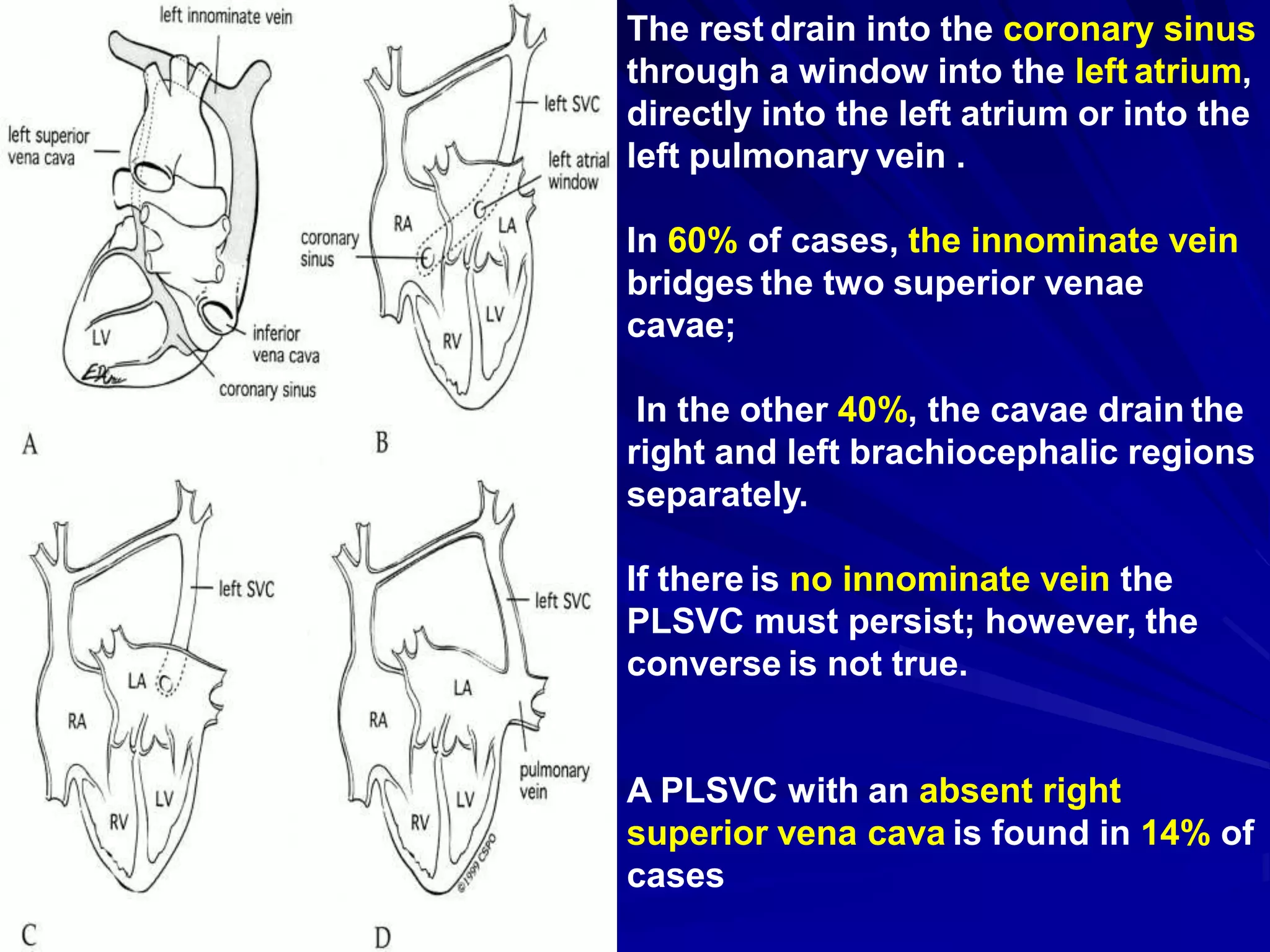 Cardiac venous system | PPTX
