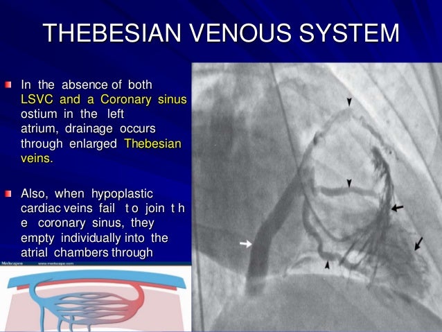 Cardiac venous system