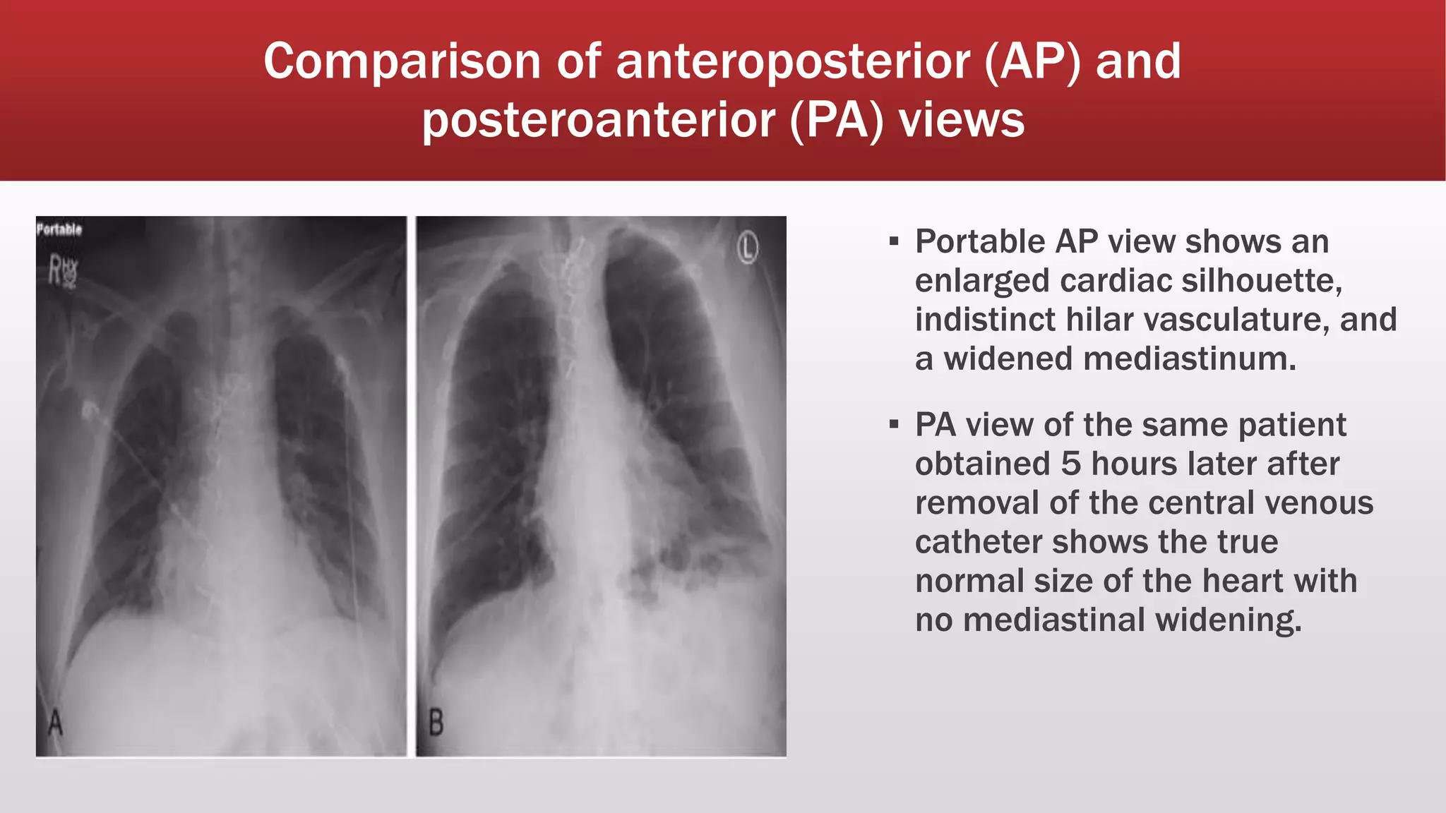 Cardiac X-ray .pptx