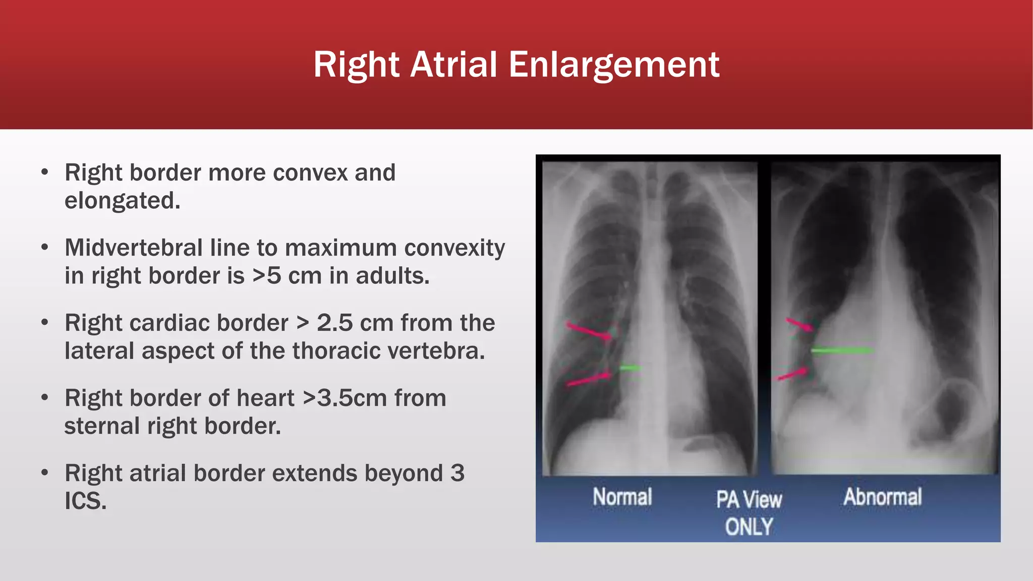 Cardiac X-ray .pptx