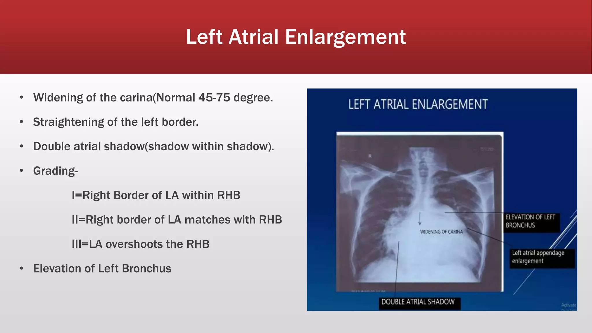 Cardiac X-ray .pptx