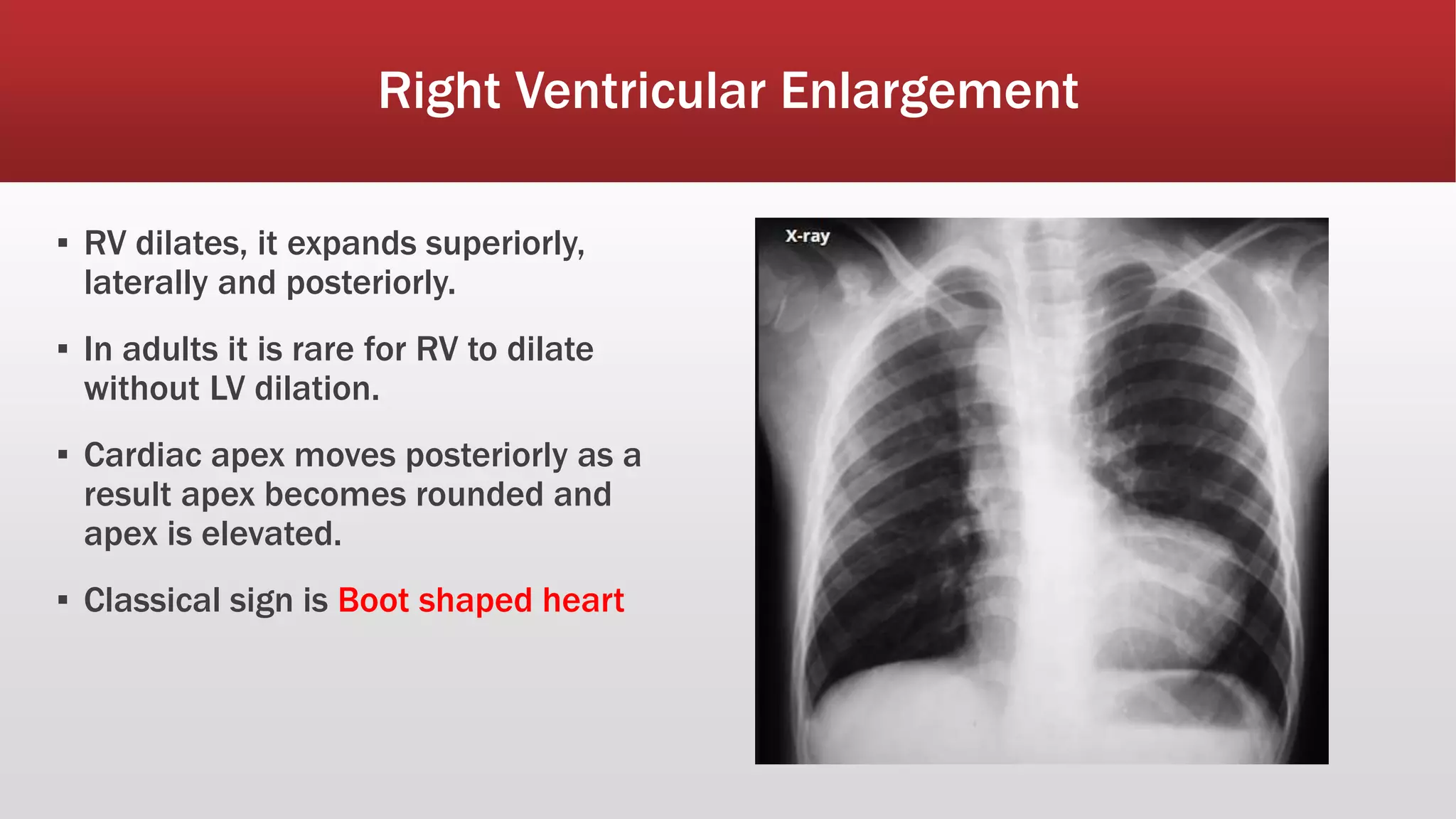 Cardiac X-ray .pptx