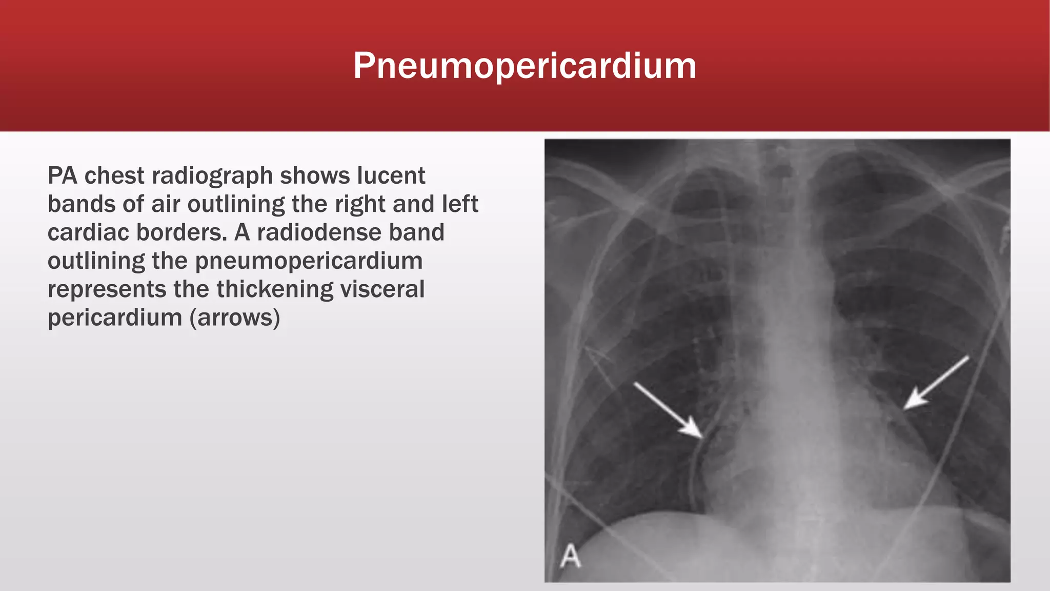 Cardiac X-ray .pptx