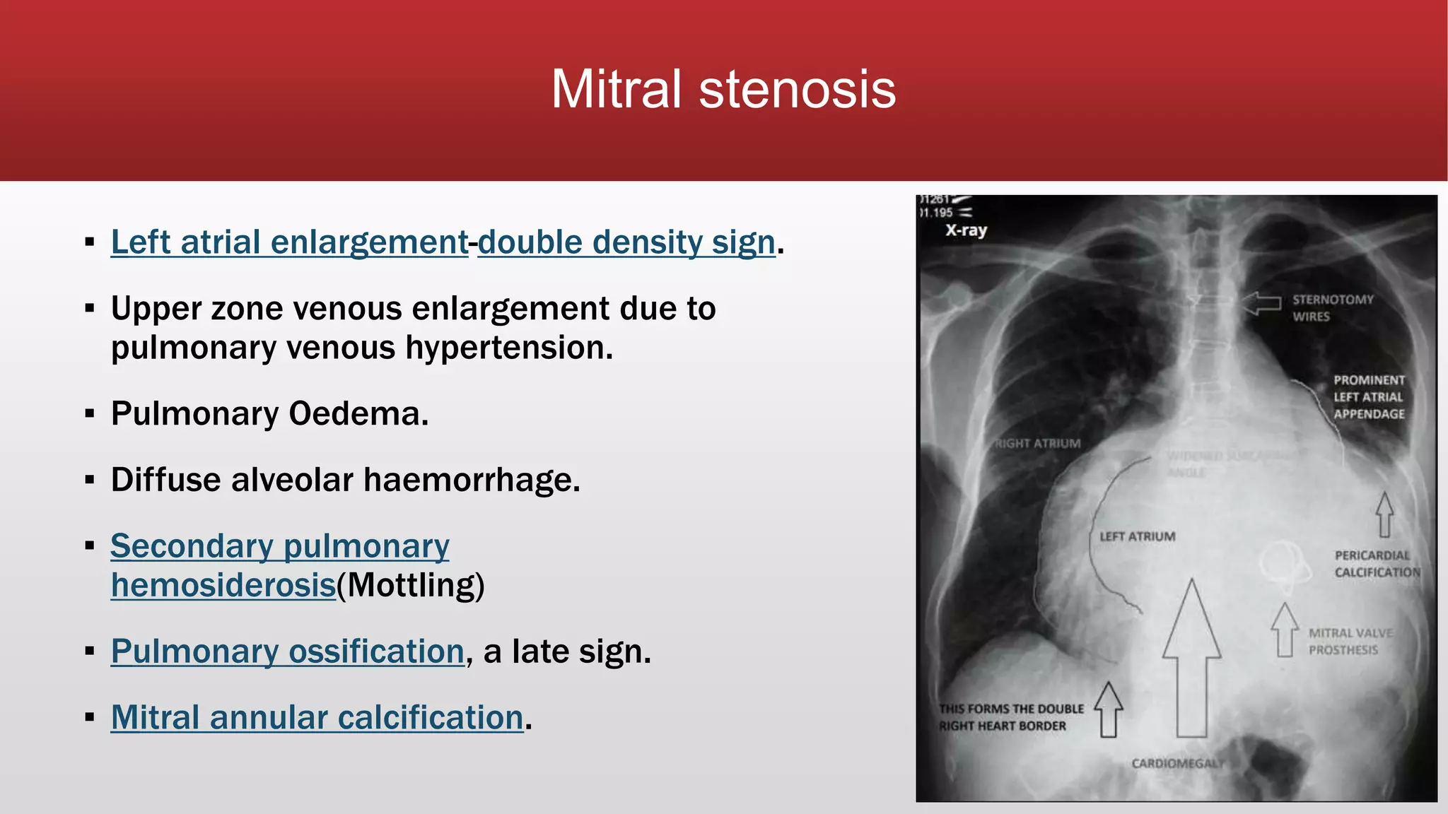 Cardiac X-ray .pptx