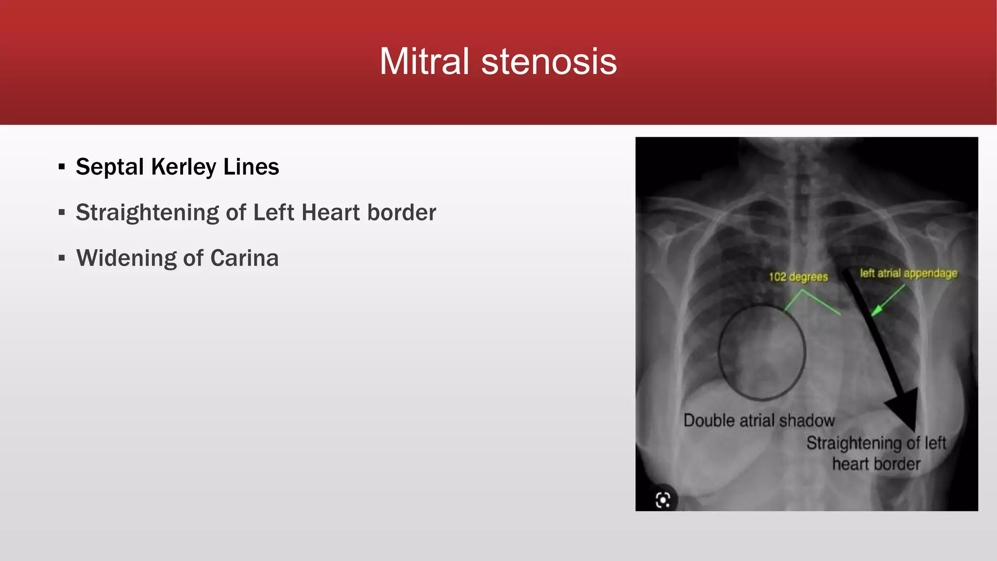 Cardiac X-ray .pptx