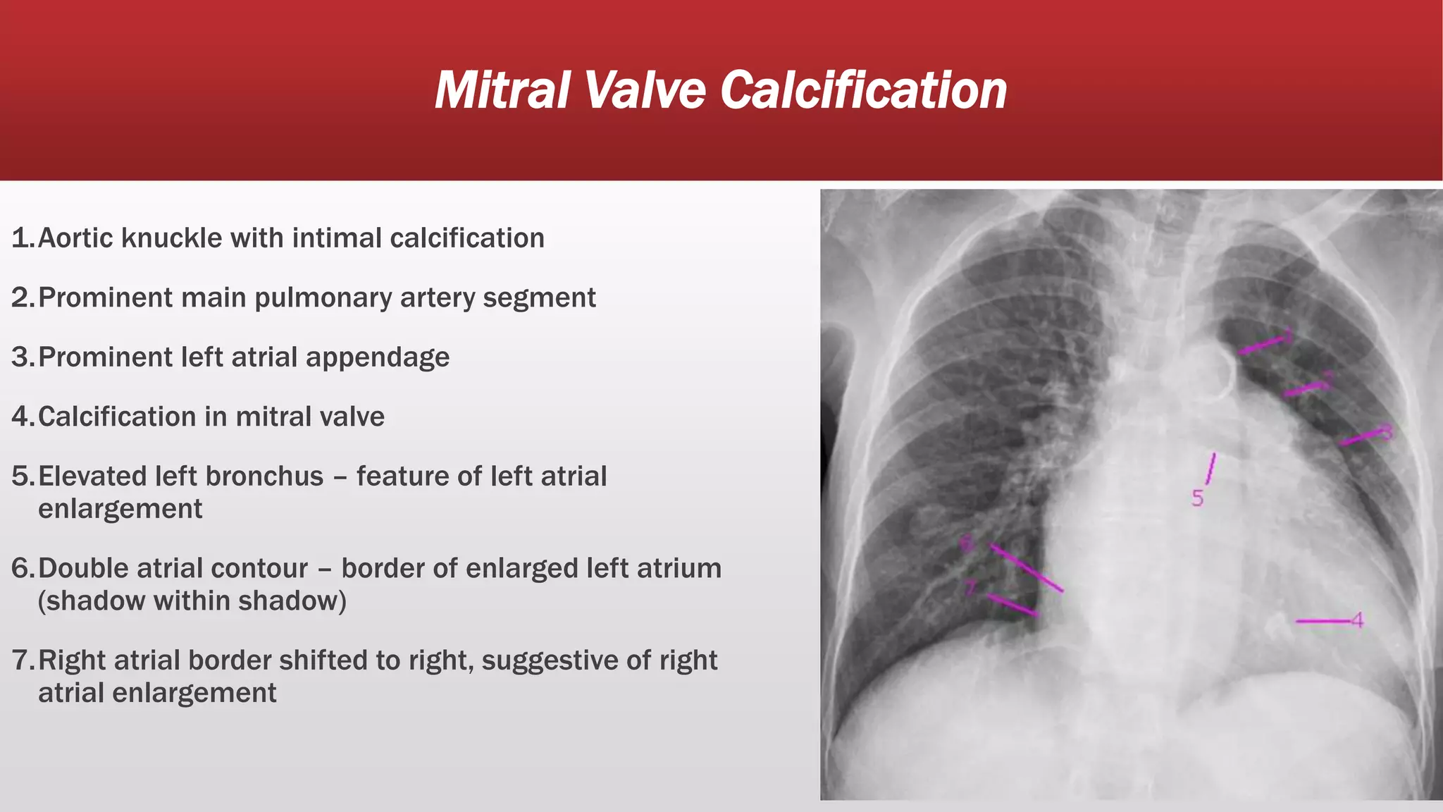 Cardiac X-ray .pptx