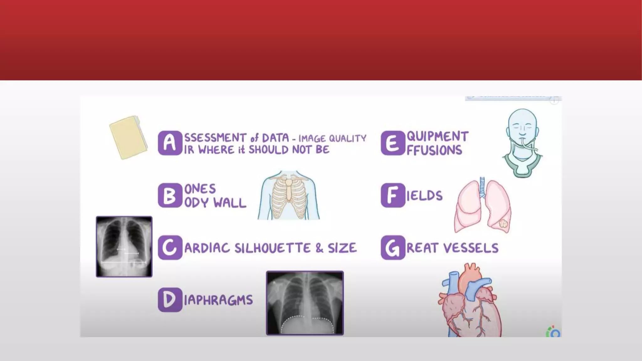 Cardiac X-ray .pptx