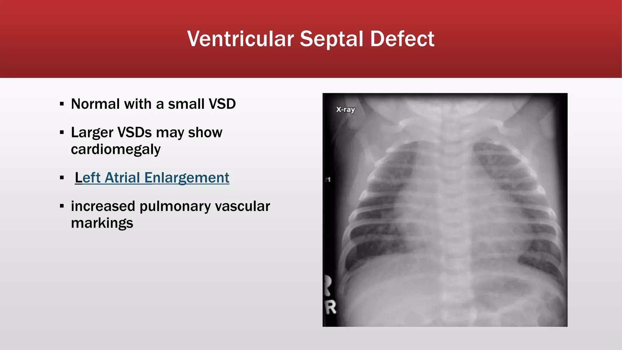 Cardiac X-ray .pptx