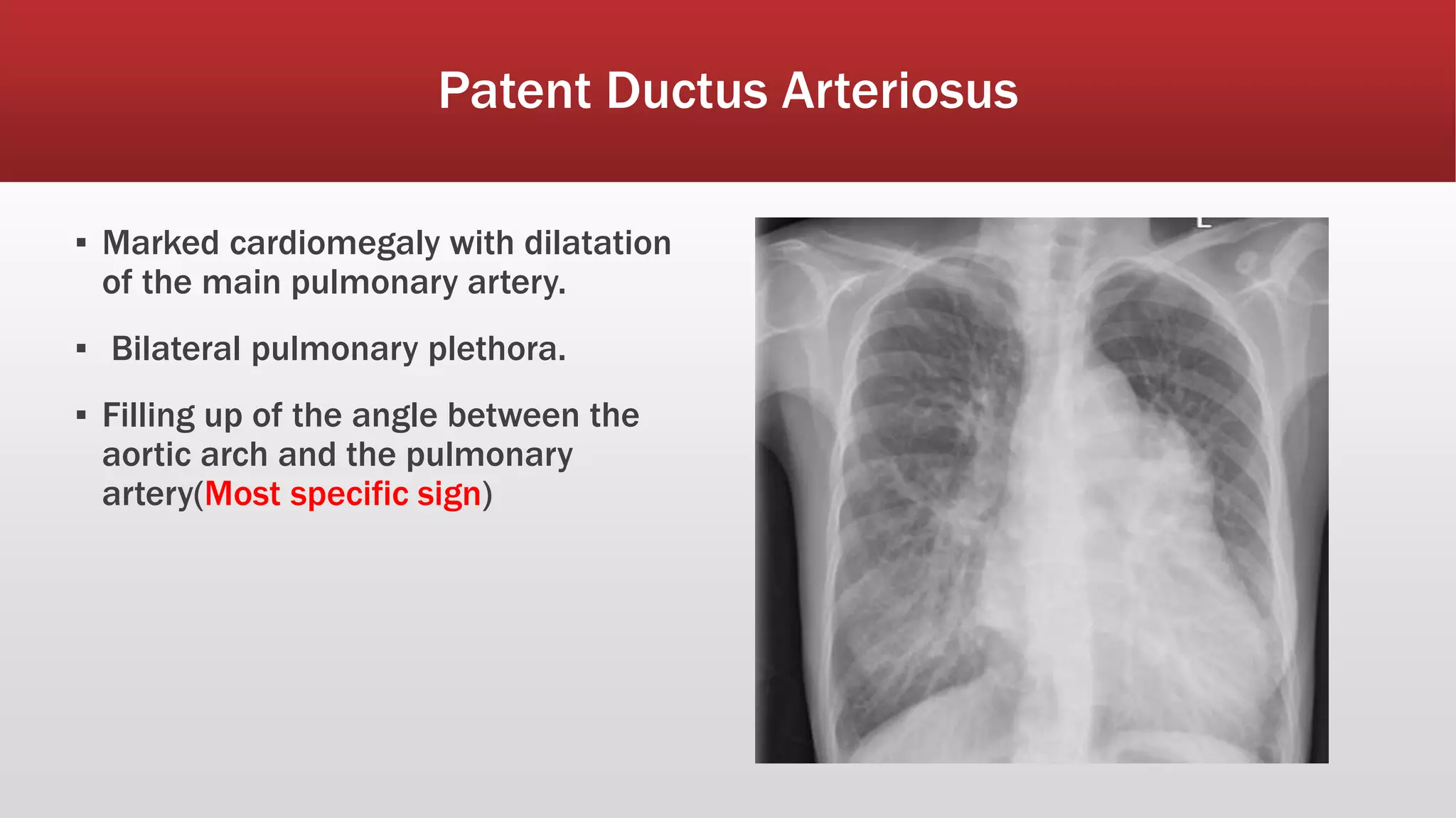 Cardiac X-ray .pptx