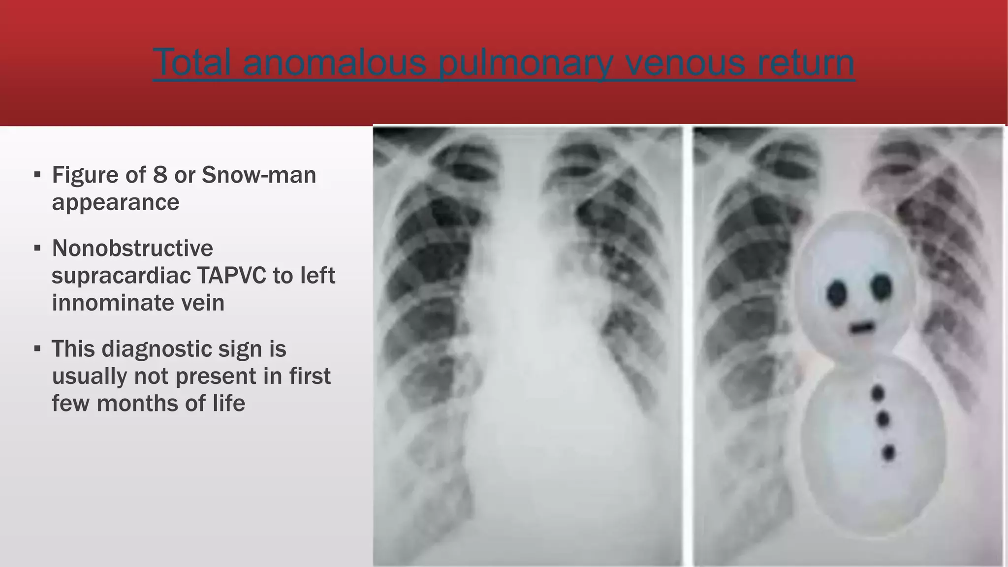 Cardiac X-ray .pptx