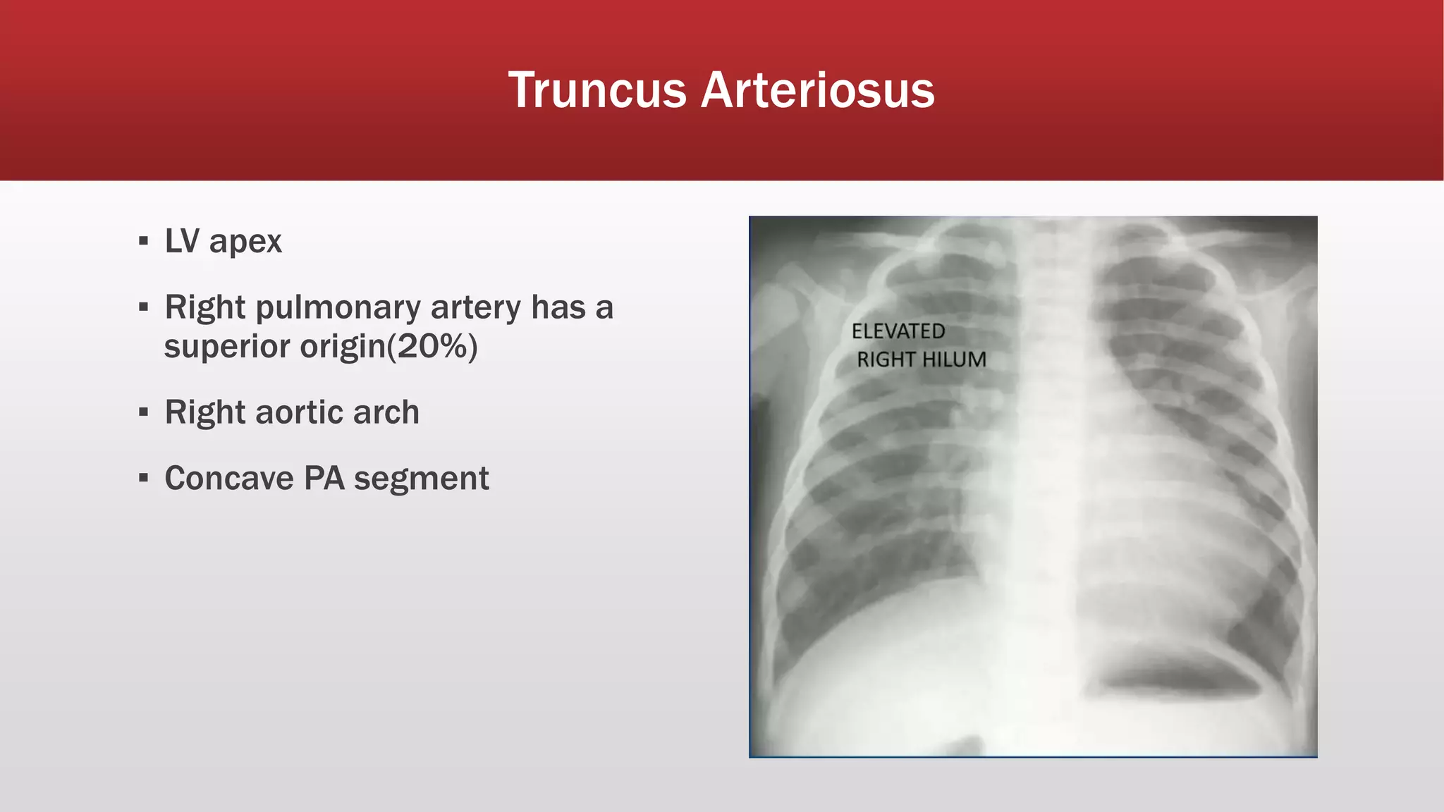 Cardiac X-ray .pptx