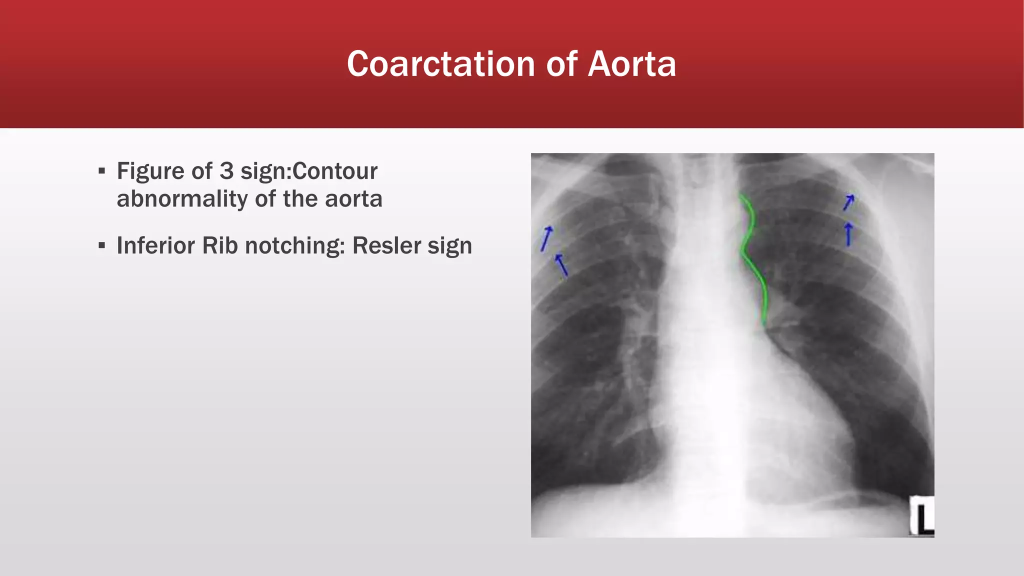 Cardiac X-ray .pptx