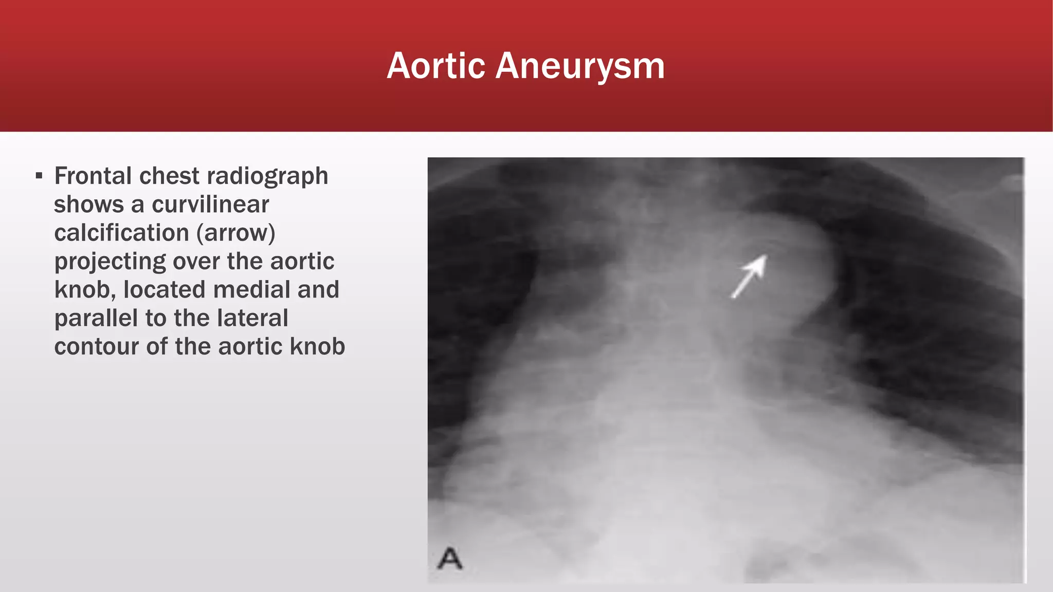 Cardiac X-ray .pptx