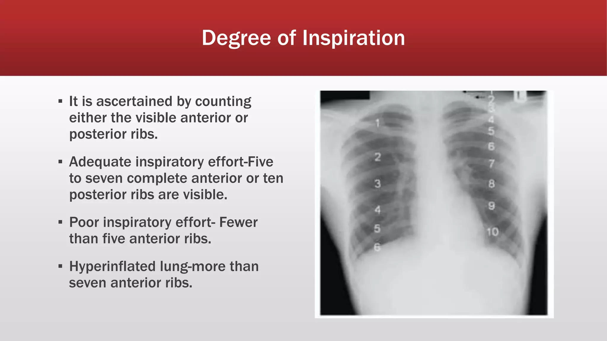 Cardiac X-ray .pptx