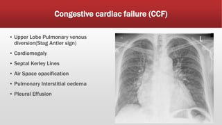Cardiac X-ray .pptx