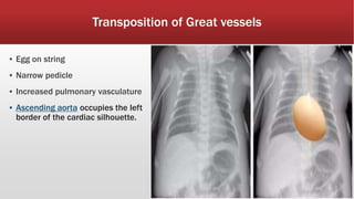 Cardiac X-ray .pptx