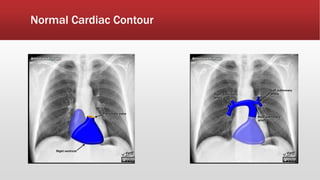 Cardiac X-ray .pptx
