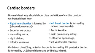 Radiographic approach to cardiac xray presentation.pptx