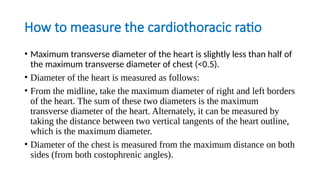 Radiographic approach to cardiac xray presentation.pptx
