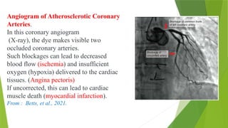 Cardiad term L4.pptx/ medical termonology | PPTX