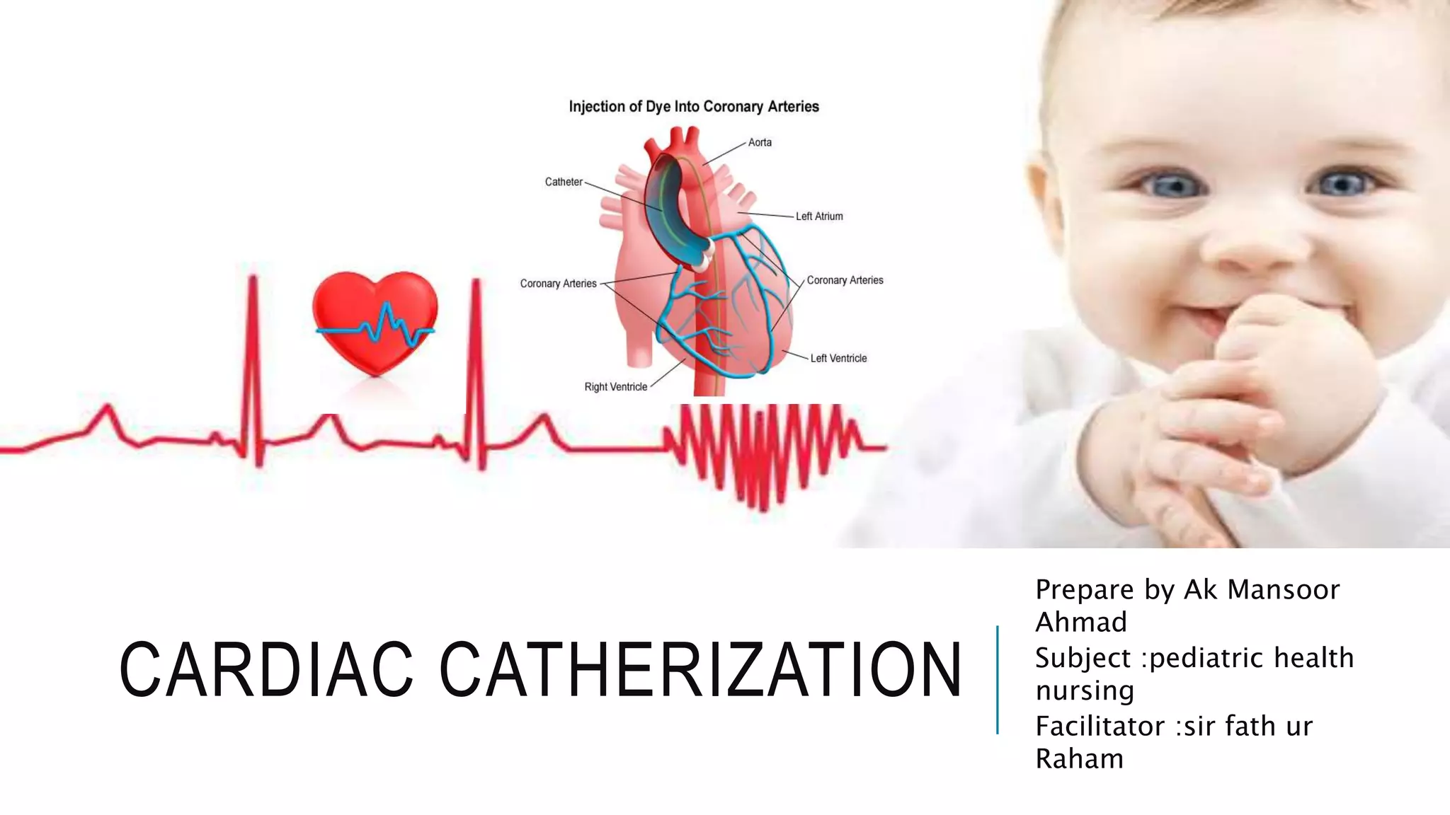Cardiac catherization | PPTX