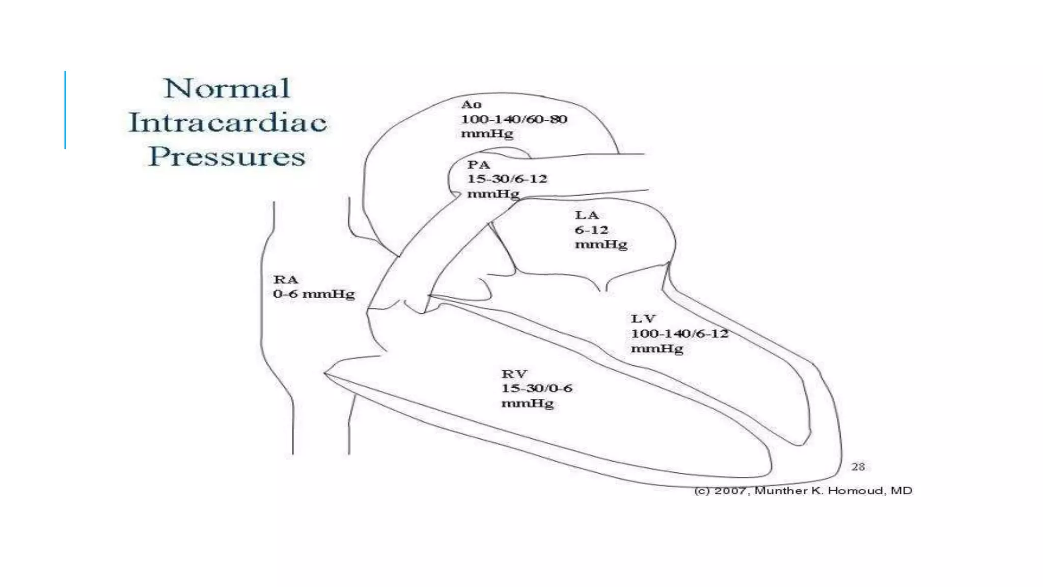 Cardiac catherization | PPTX