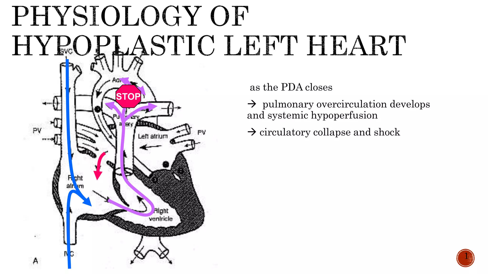 cardiac emergencice im pediatrics | PPTX