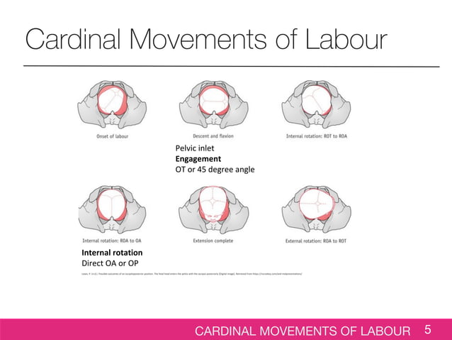 Cardinal movements-of-labour-1 | PDF | Pregnancy | Reproductive Health