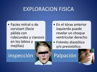 estenosis mitral, prolapso de la valvula mitral, estenosis aortica e ...