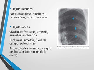 Cardio | PPTX