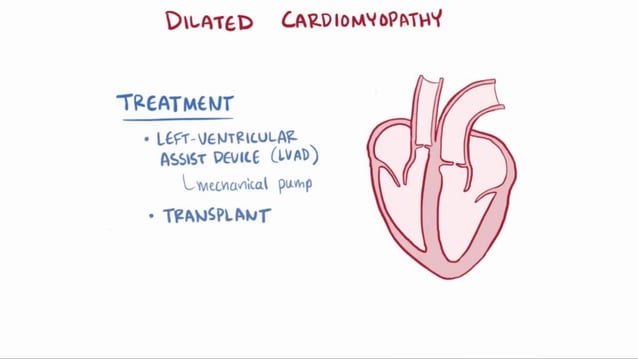 Osmosis: Dilated Cardiomyopathy | PPT