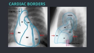 CARDIO-Lecture.pptxx cardiac radiographs | PPTX